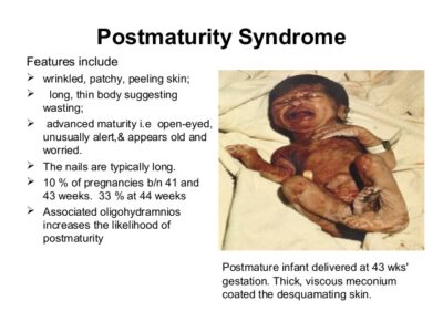 Your most rapid and crucial aging may occur in utero – Recharge Biomedical